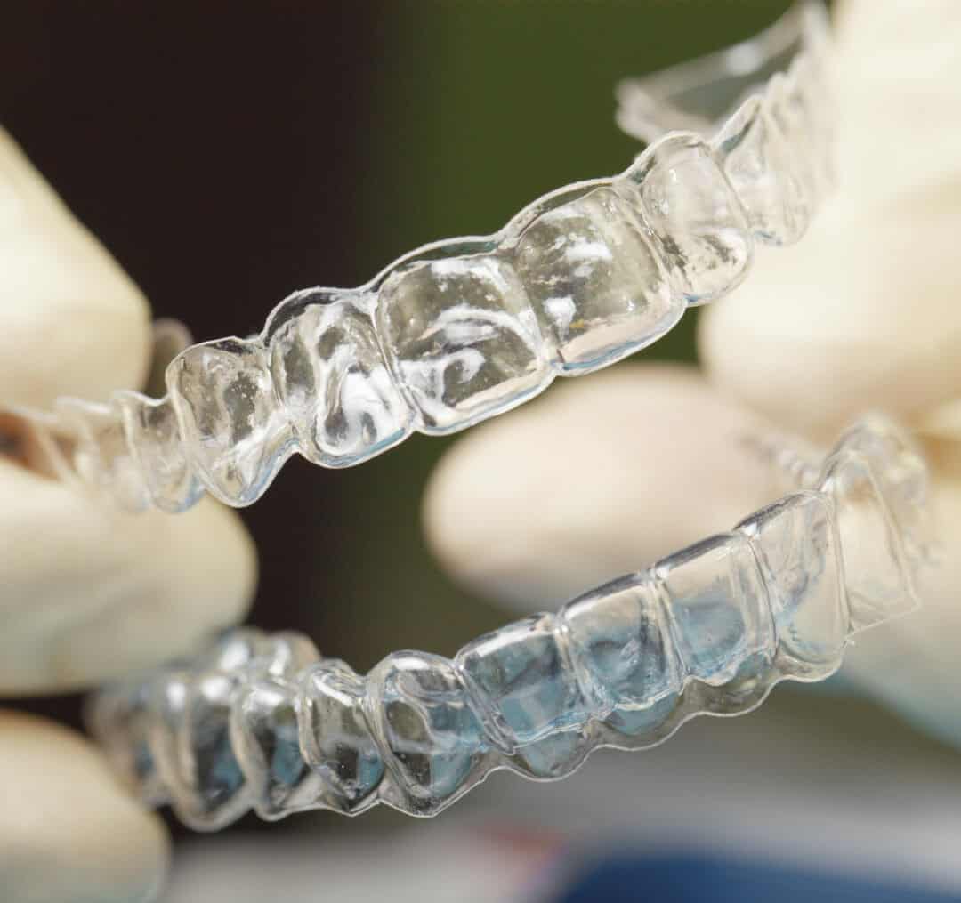 Invisalign Treatment in Zanesville, Ohio | Sulens Dental Studio